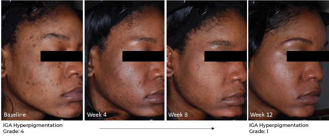 Lumicyn™ Pure - Unigen