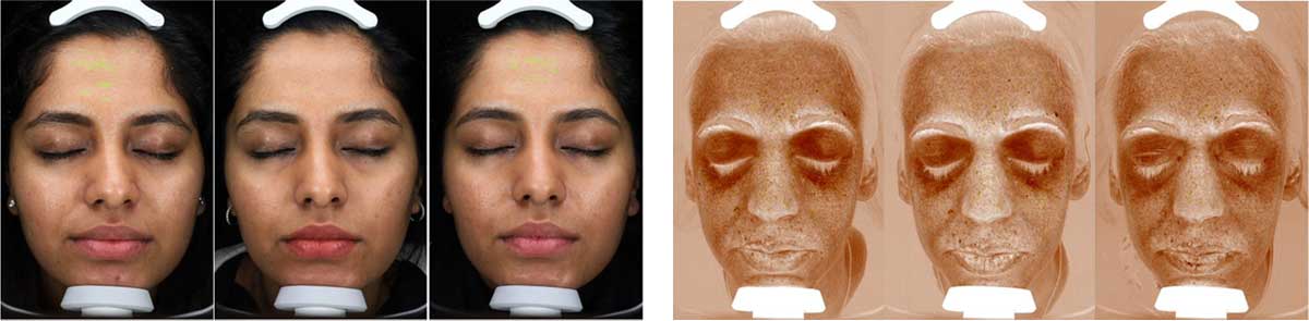 FeraLuxe™ - Unigen